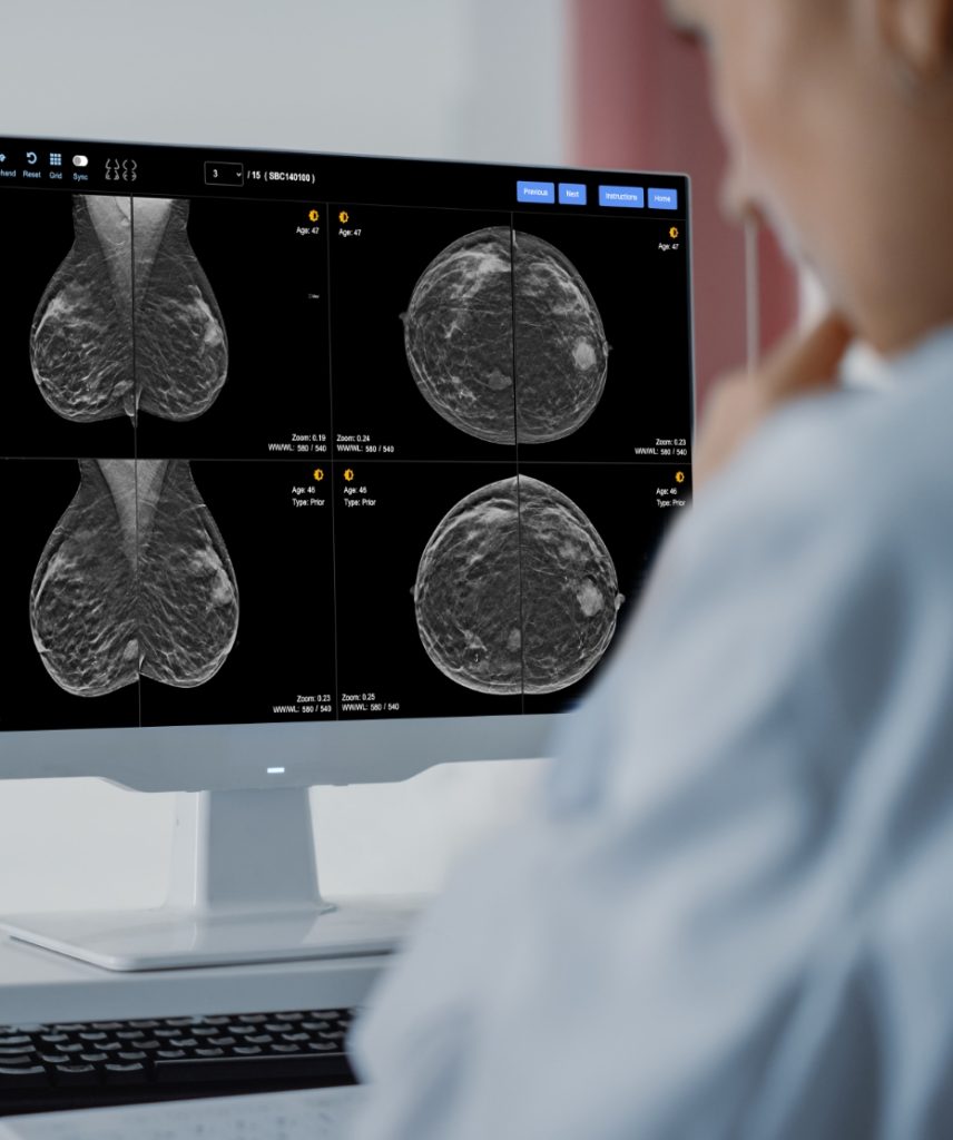 Breast Screening Clinics | DetectedX | Improving Diagnostic Accuracy